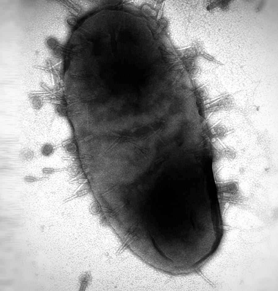 HU researchers name superbug treatment for patient who inspired its ...