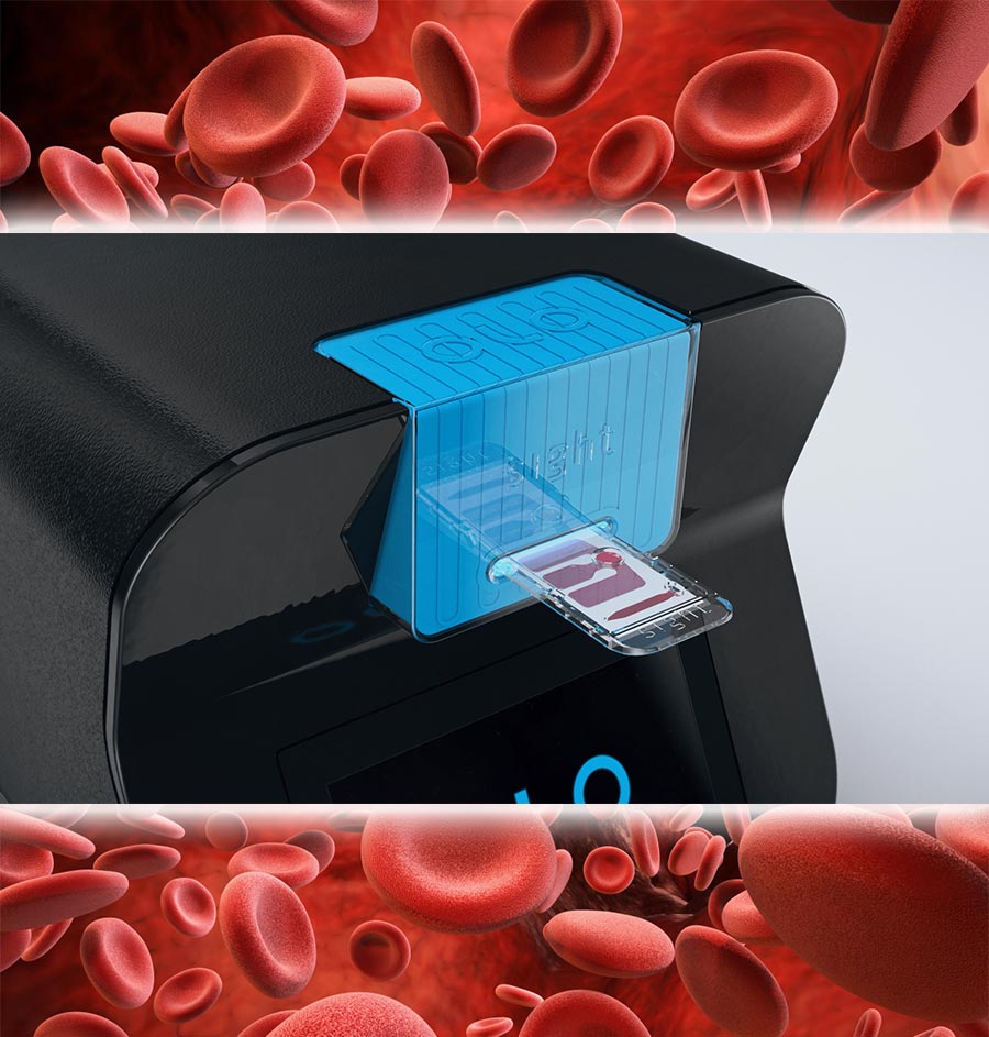 HU alum’s startup involving blood test succeeds where Theranos failed ...